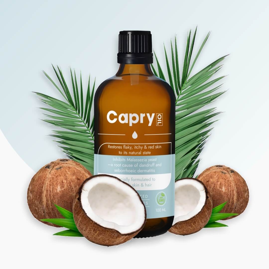 Capry: your new solution for dandruff and red, itchy, and scaly skin ...
